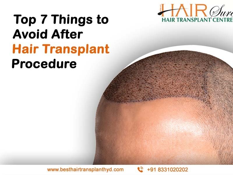 Top 7 Things To Avoid After Hair Transplant Procedure Cyber Hairsure
