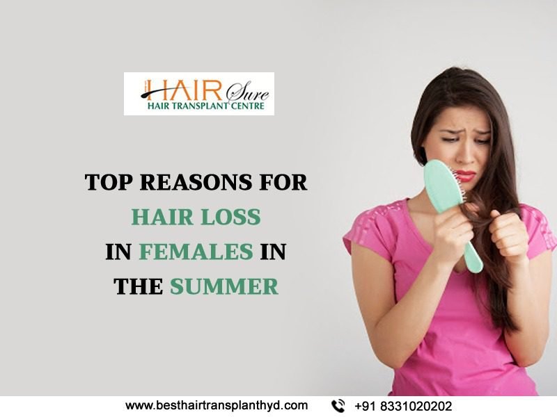 Top 5 Reasons For Hair Loss In Females In The Summer Cyber Hairsure